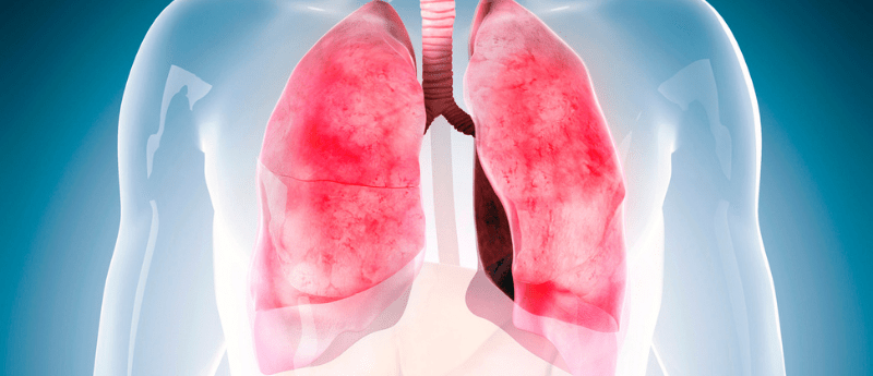 US FDA approves new Prograf use, supported by real-world evidence ...