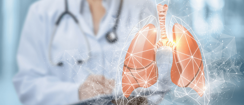 Boehringer Ingelheim and Strados Labs to carry out pilot study of ...